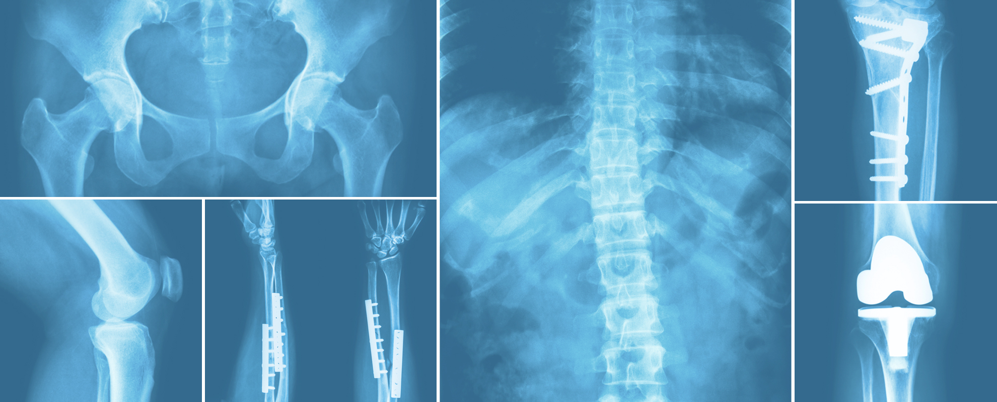 Le Patologie trattate con le nostre Terapie | IGEA Medical